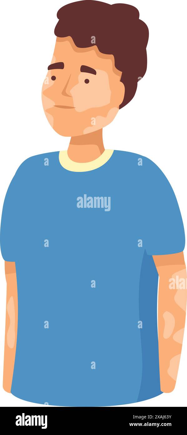 Young man with vitiligo is standing calmly showing his skin ...