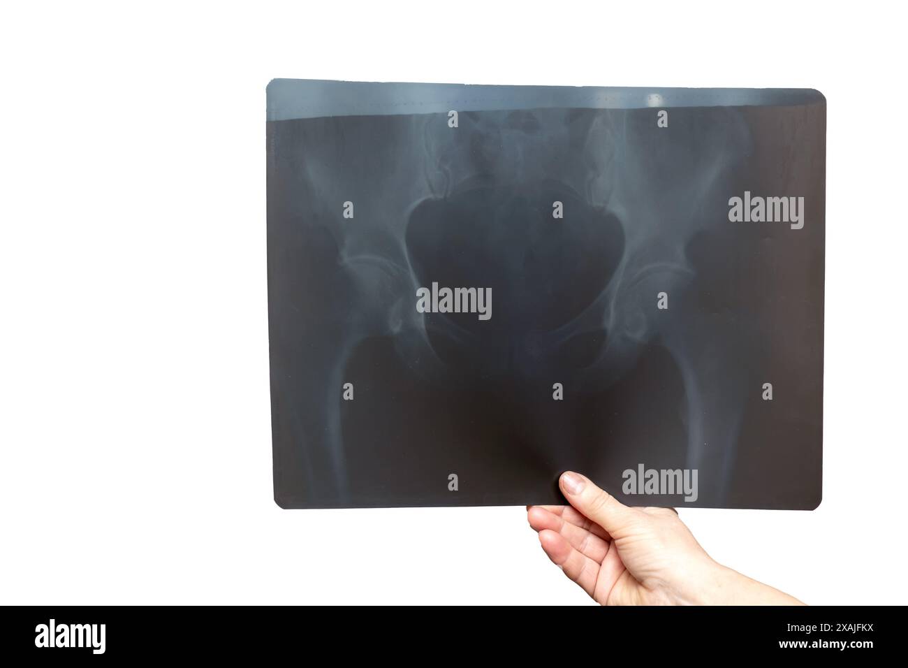 Radiology positioning hi-res stock photography and images - Alamy