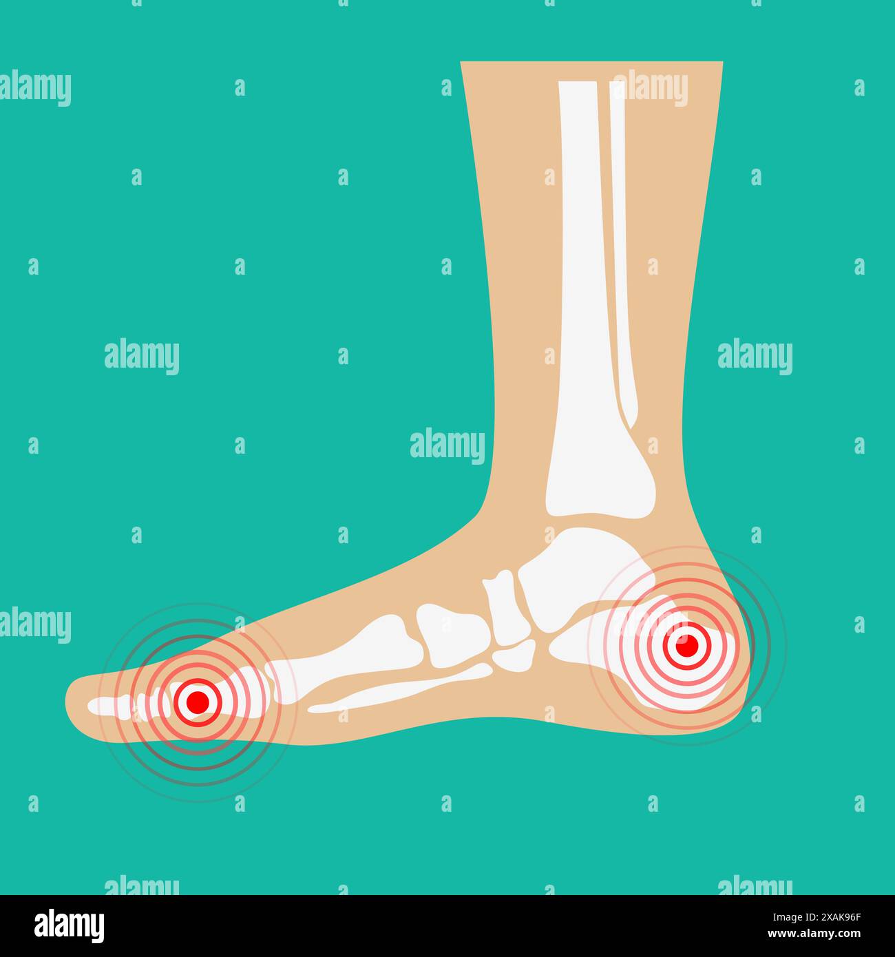 Human knee closeup Stock Vector Images - Alamy