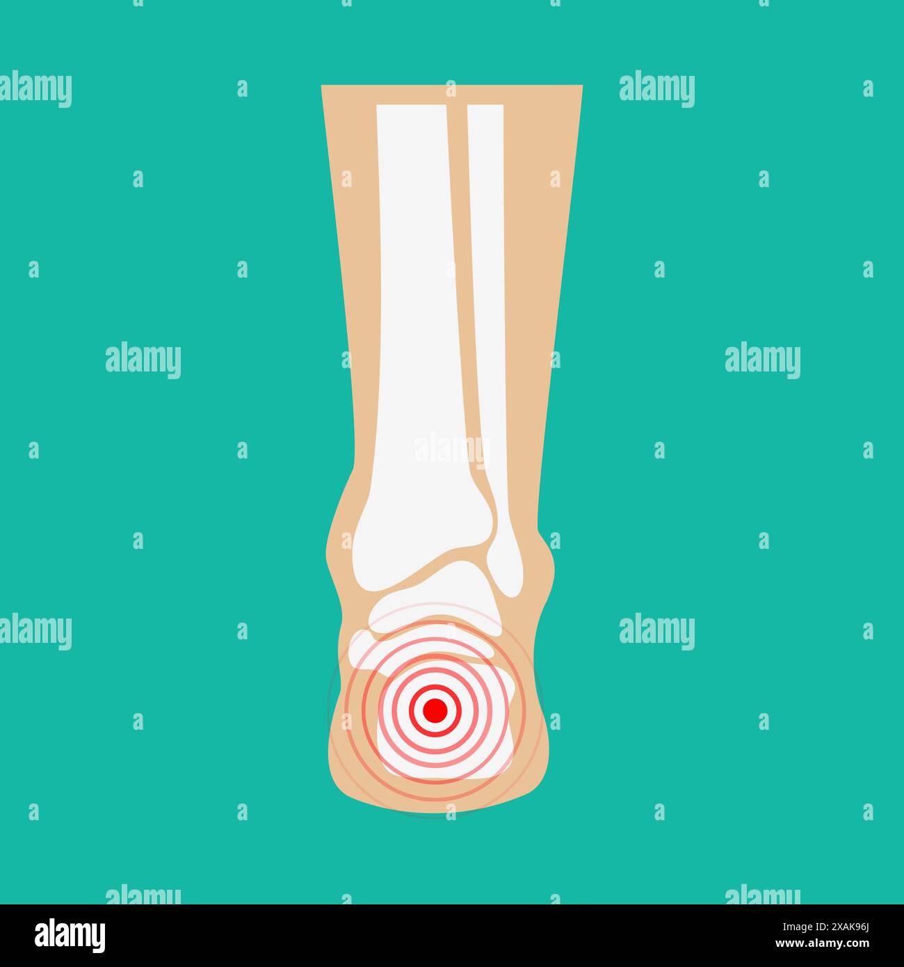 Human knee closeup Stock Vector Images - Alamy