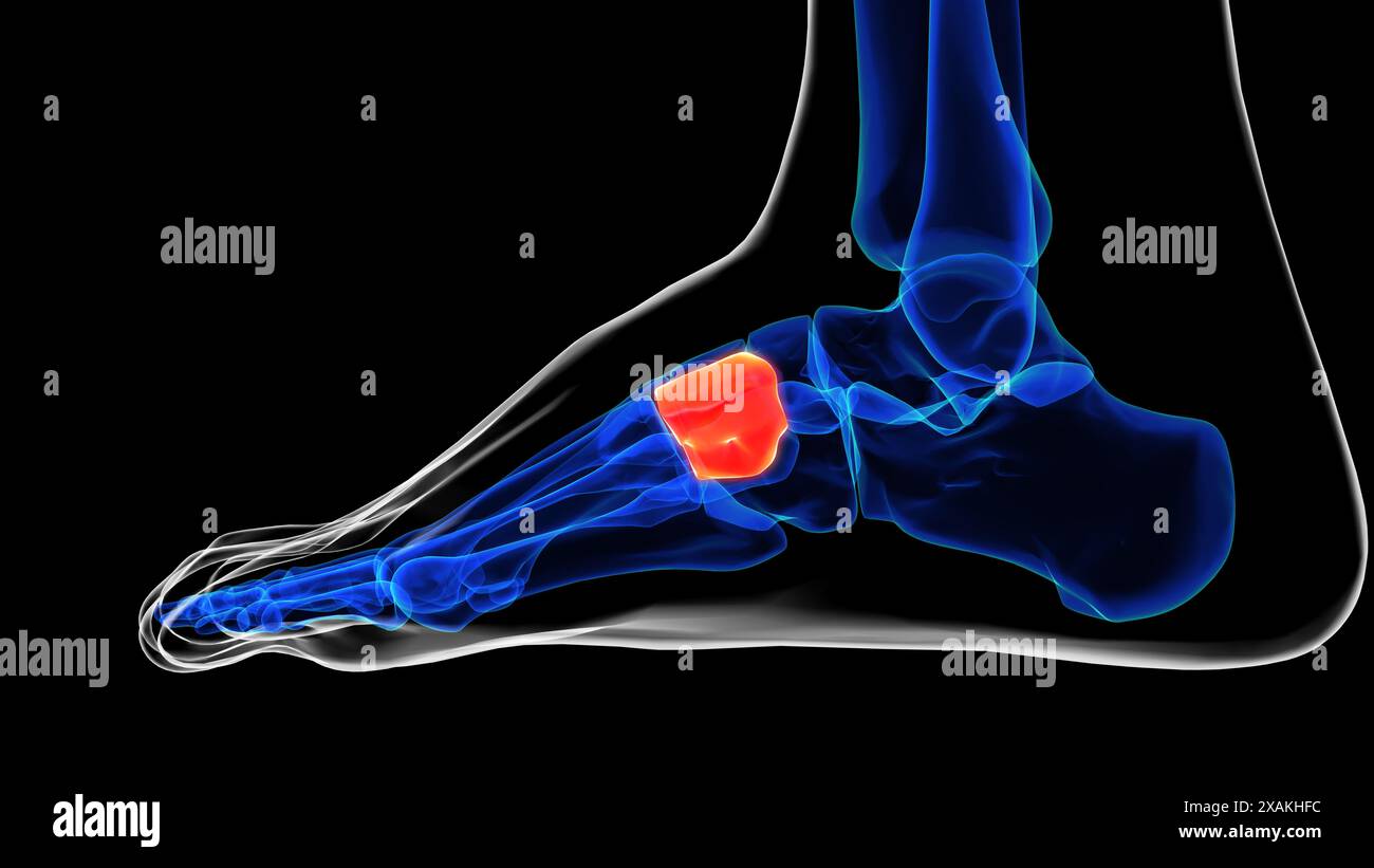 Lateral view of cuneiform bone foot bones anatomy for medical Concept ...