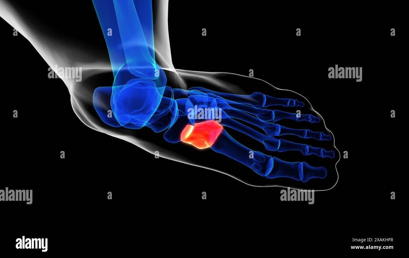 Dorsal view of foot bones medial cuneiform bone anatomy for medical ...