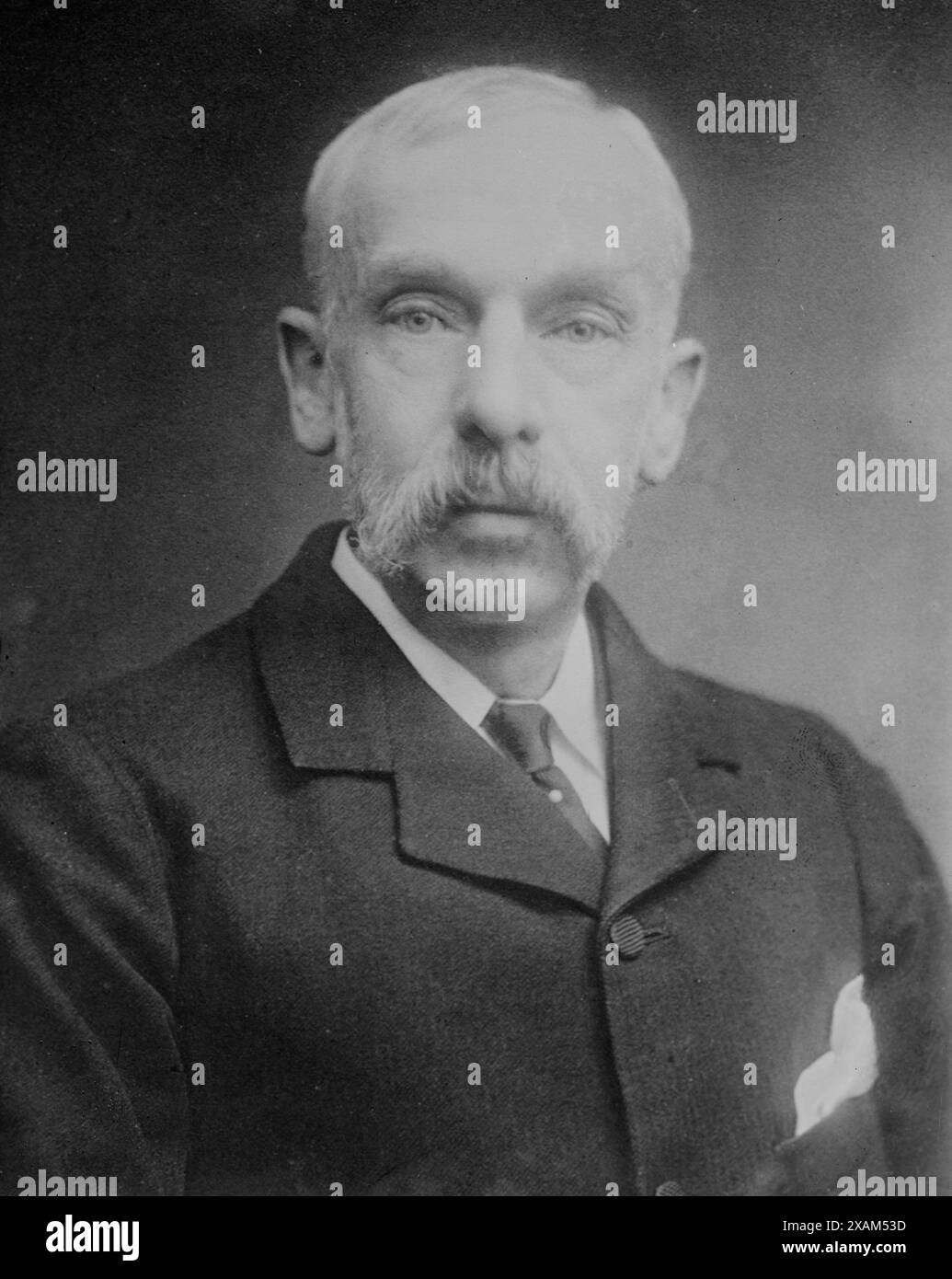 Facial hair remove Black and White Stock Photos & Images - Alamy