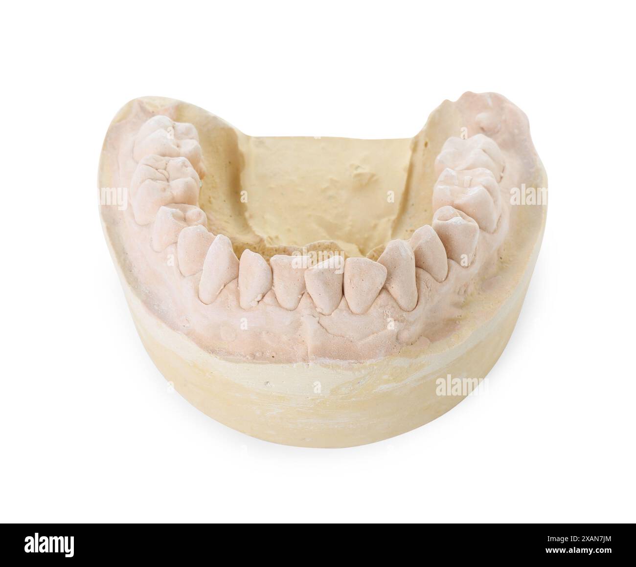 Dental model with jaw isolated on white. Cast of teeth Stock Photo - Alamy