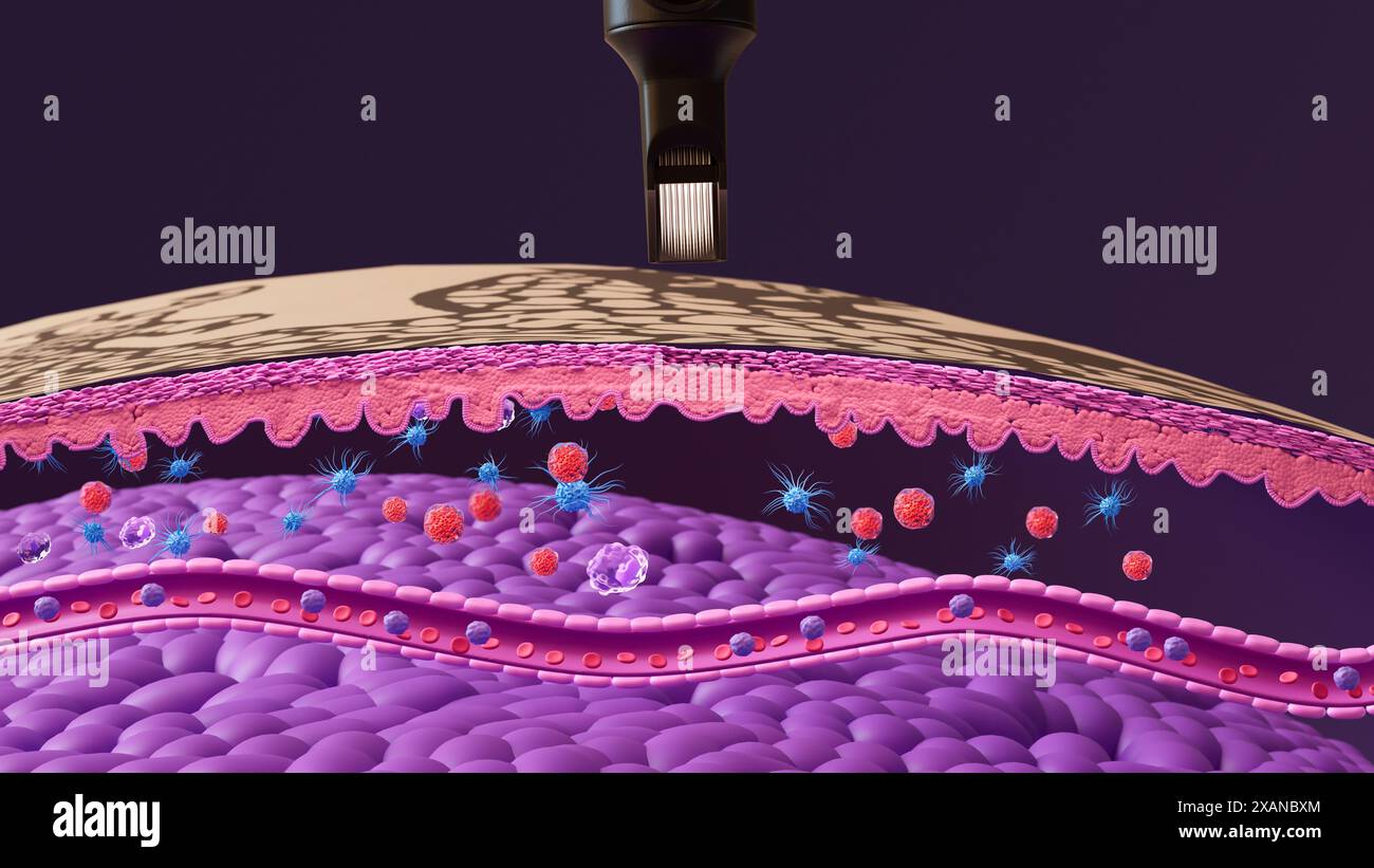 Illustration showing the skin tissue of an arm being tattooed by a ...