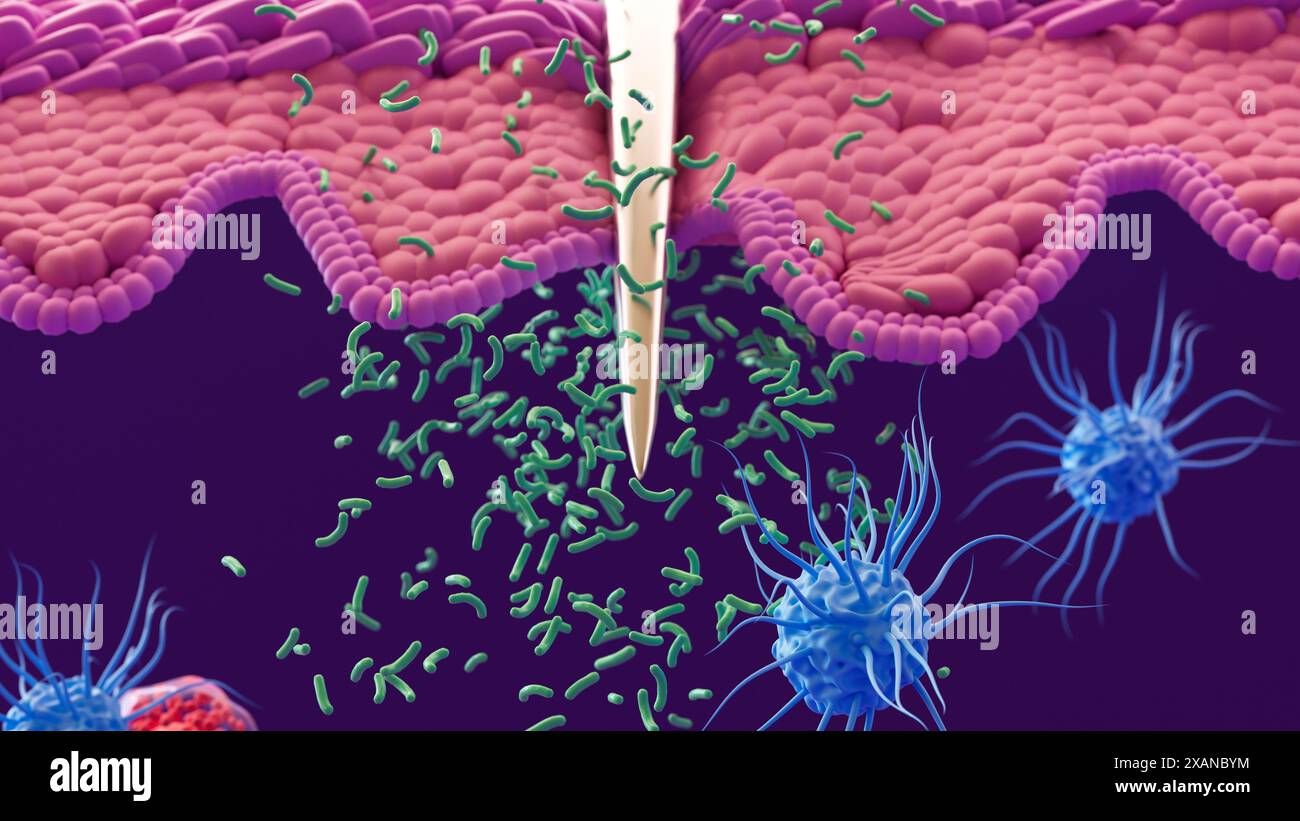 Bacteria Entering The Body