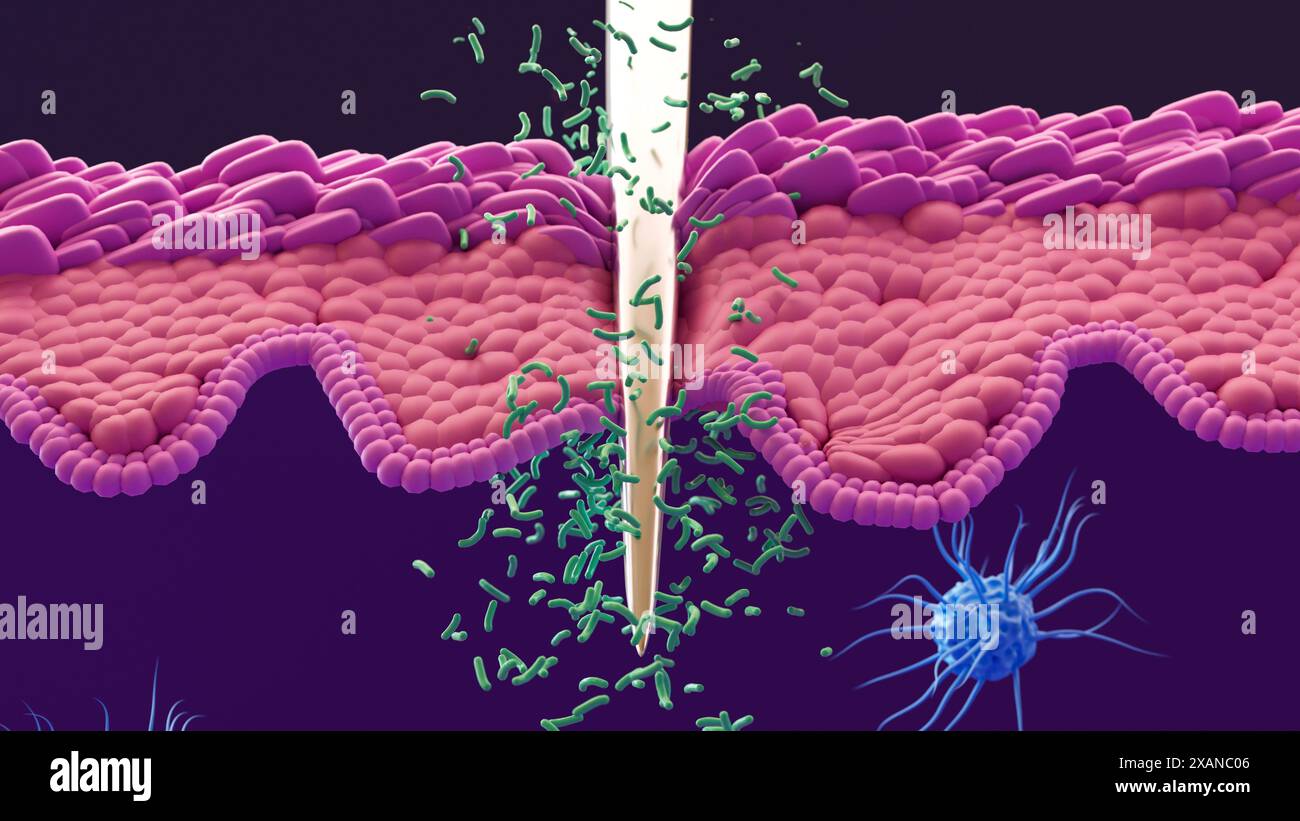 Illustration showing bacteria (green) entering the body through a ...
