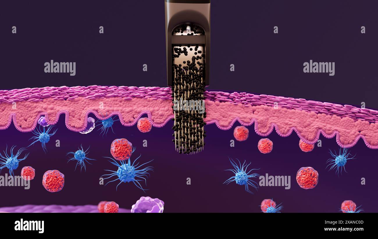 Illustration showing the skin tissue of an arm being pierced by a ...