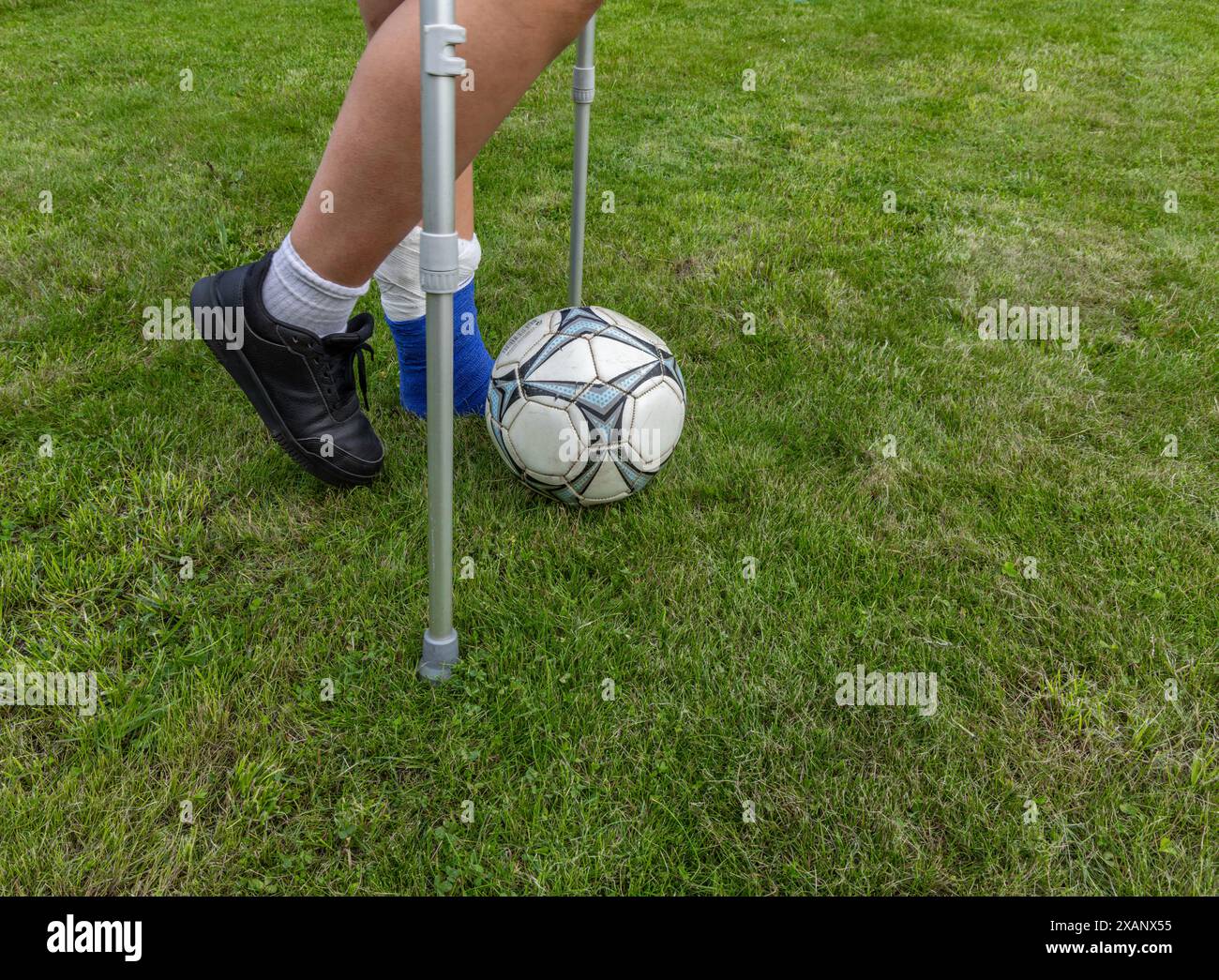 Boy with a broken leg in a cast during a football match an injury to a ...