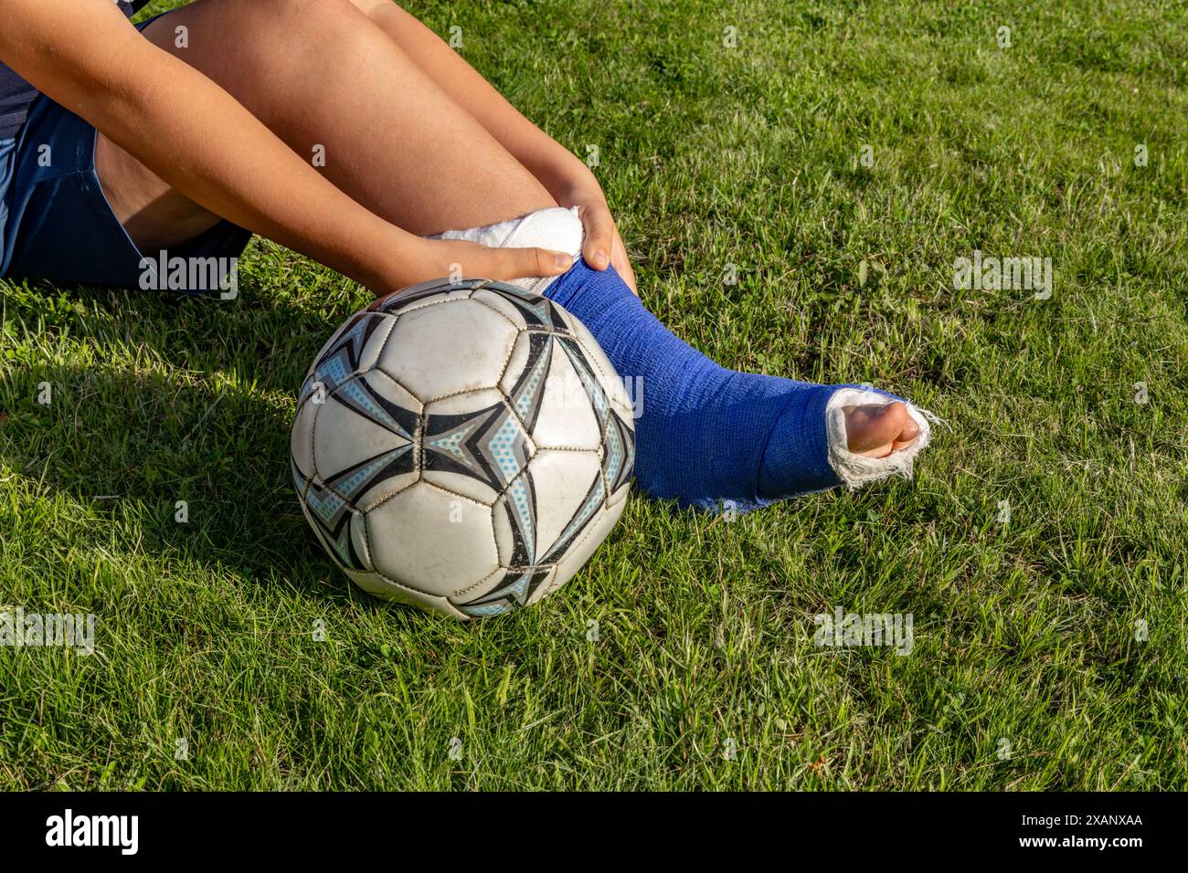 A boy with a broken leg at football training Stock Photo - Alamy
