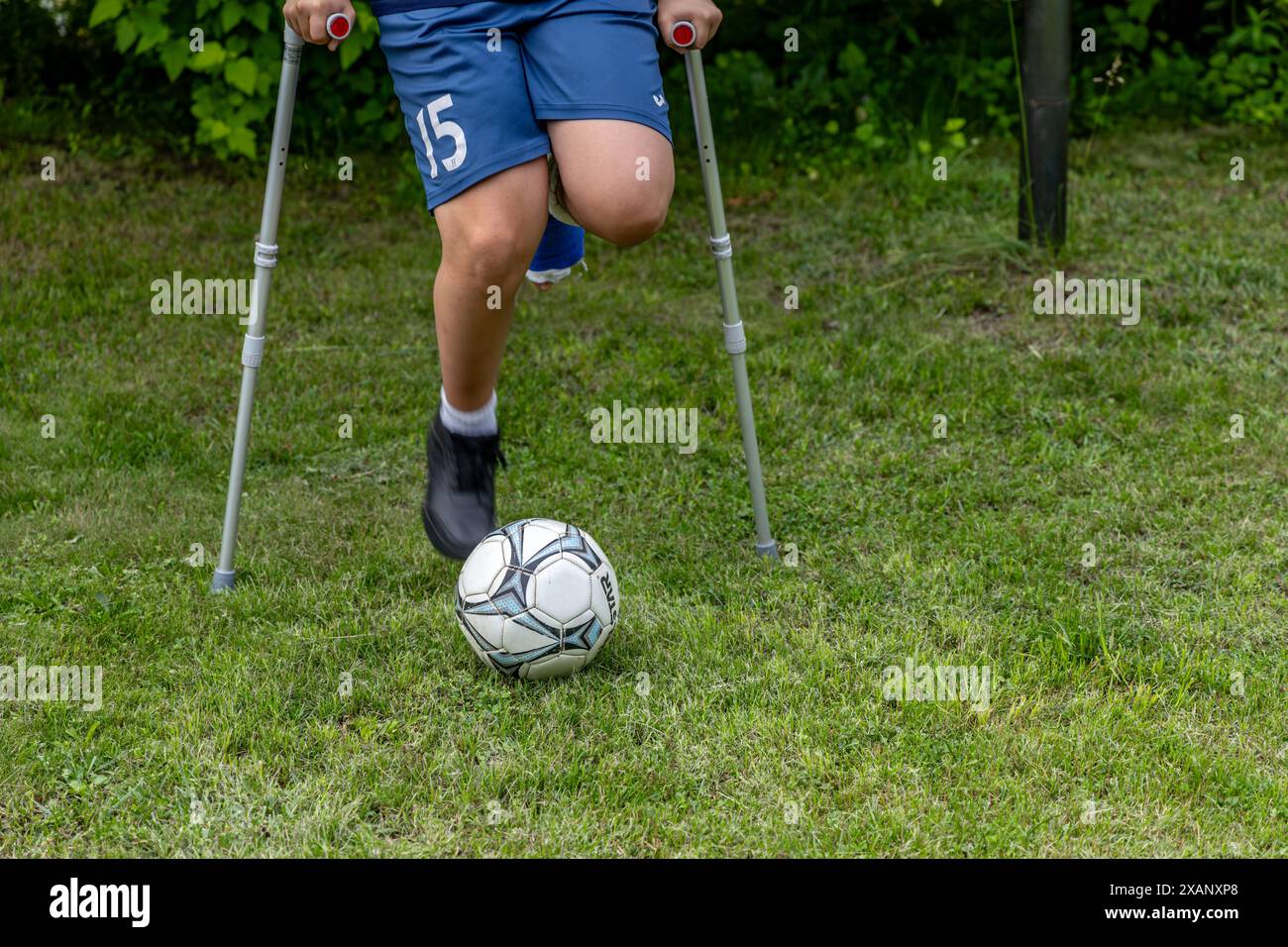 Boy with a broken leg in a cast during a football match an injury to a ...