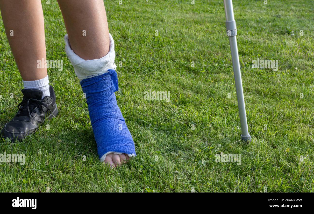 Boy with a broken leg in a cast during a football match an injury to a ...