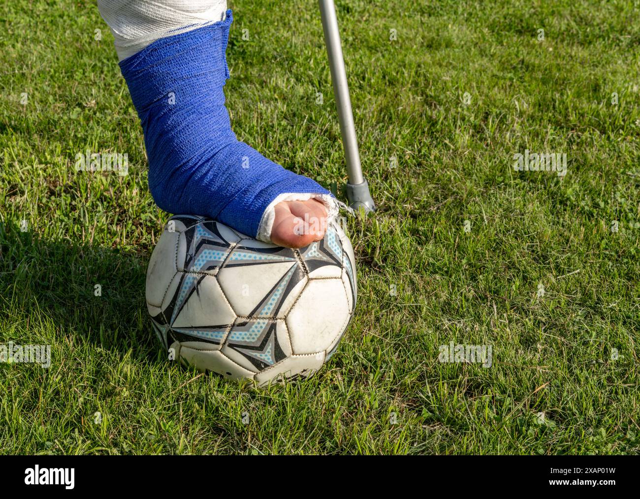 Boy with a broken leg in a cast during a football match an injury to a ...