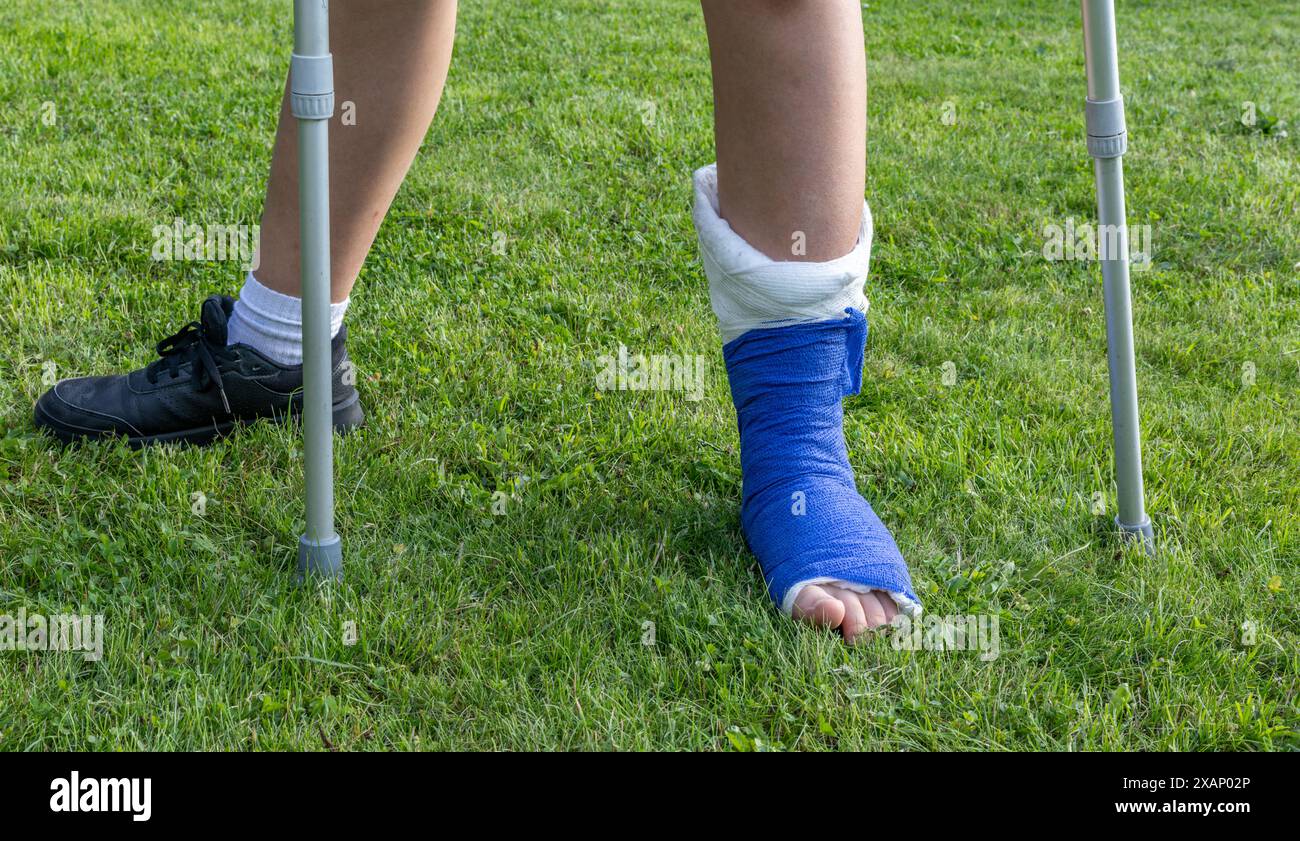 Boy with a broken leg in a cast during a football match an injury to a ...