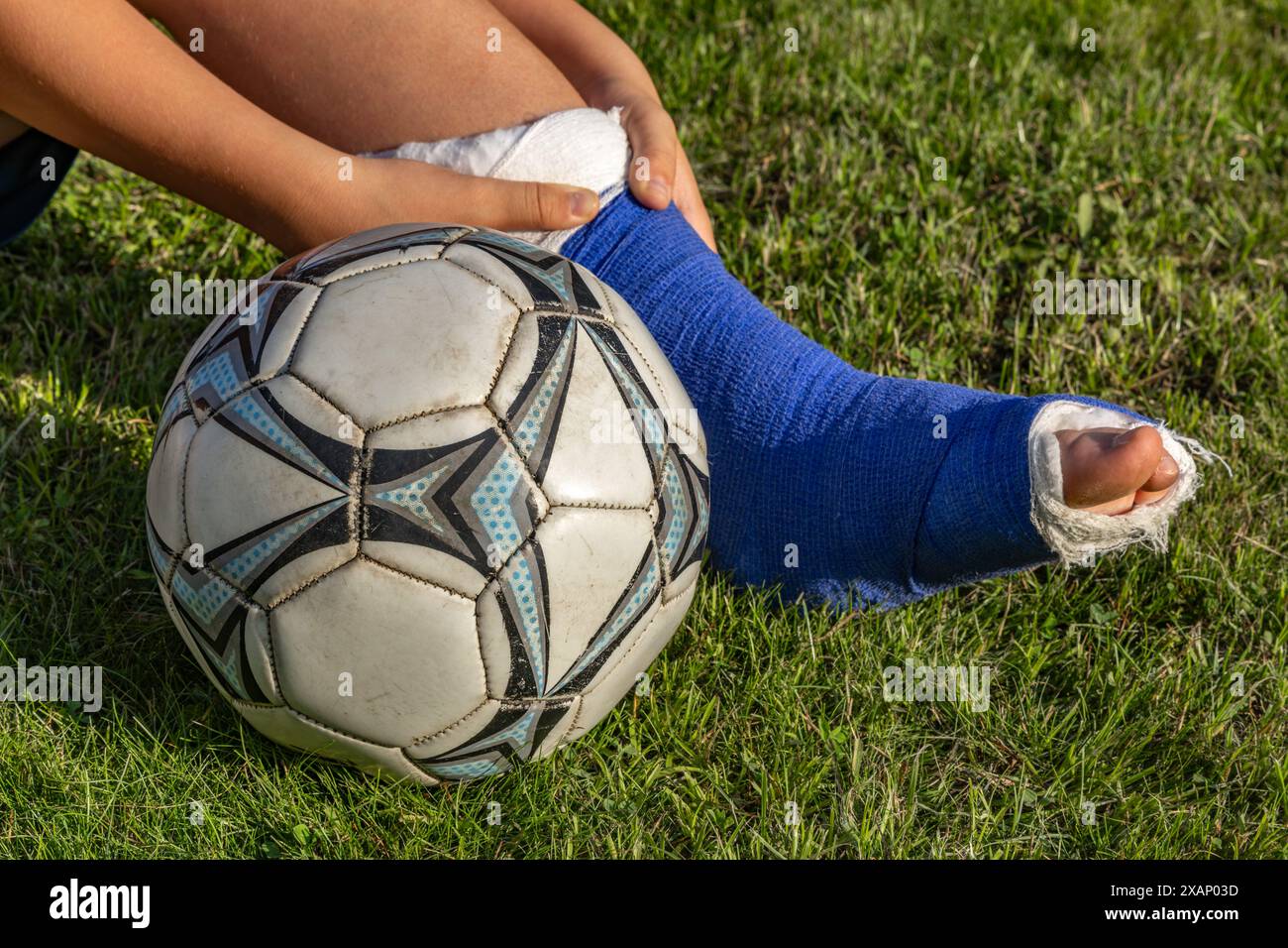 Boy with a broken leg in a cast during a football match an injury to a ...
