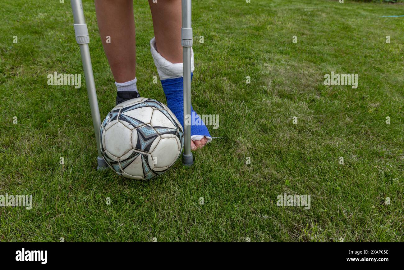 Boy with a broken leg in a cast during a football match an injury to a ...