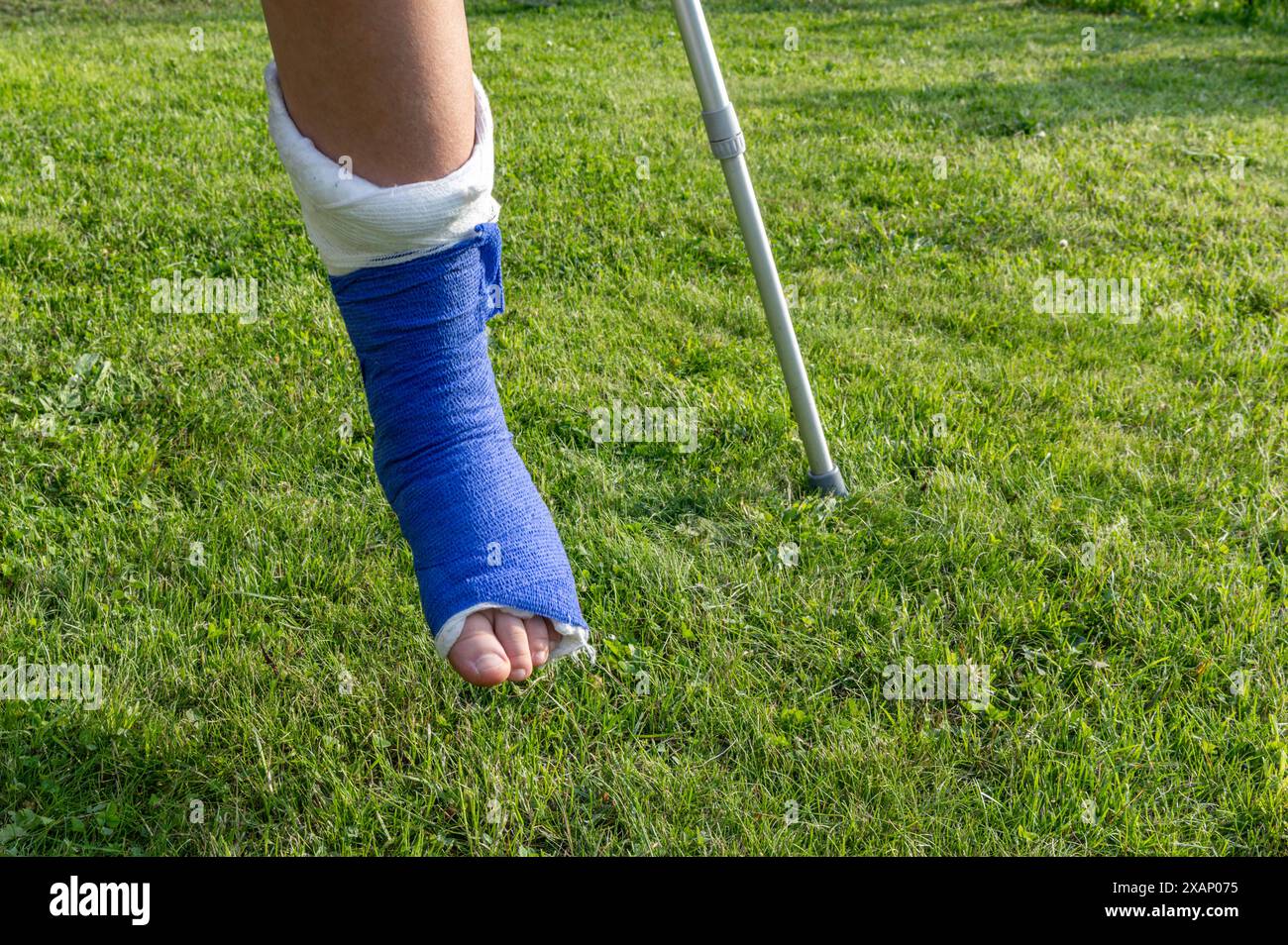 Boy with a broken leg in a cast during a football match an injury to a ...