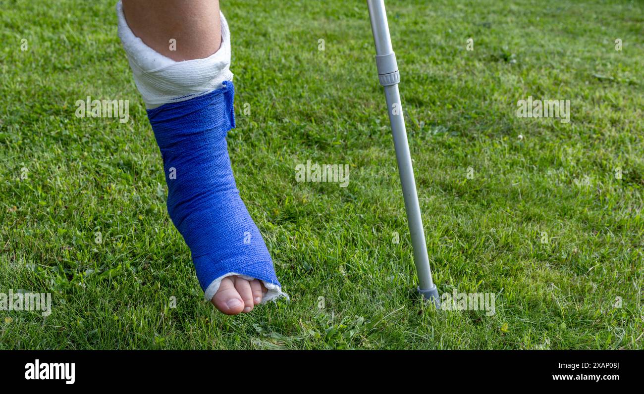 Boy with a broken leg in a cast during a football match an injury to a ...