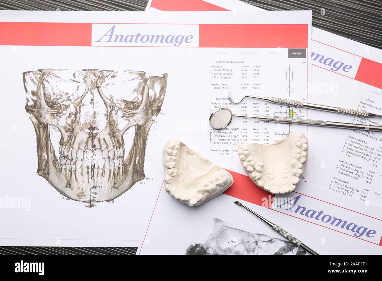 Dental model with gums, anatomy charts and dentist tools on grey wooden ...