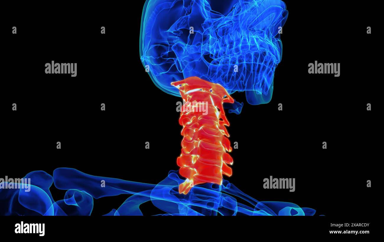 Cervical vertebral pain medical animation hi-res stock photography and ...