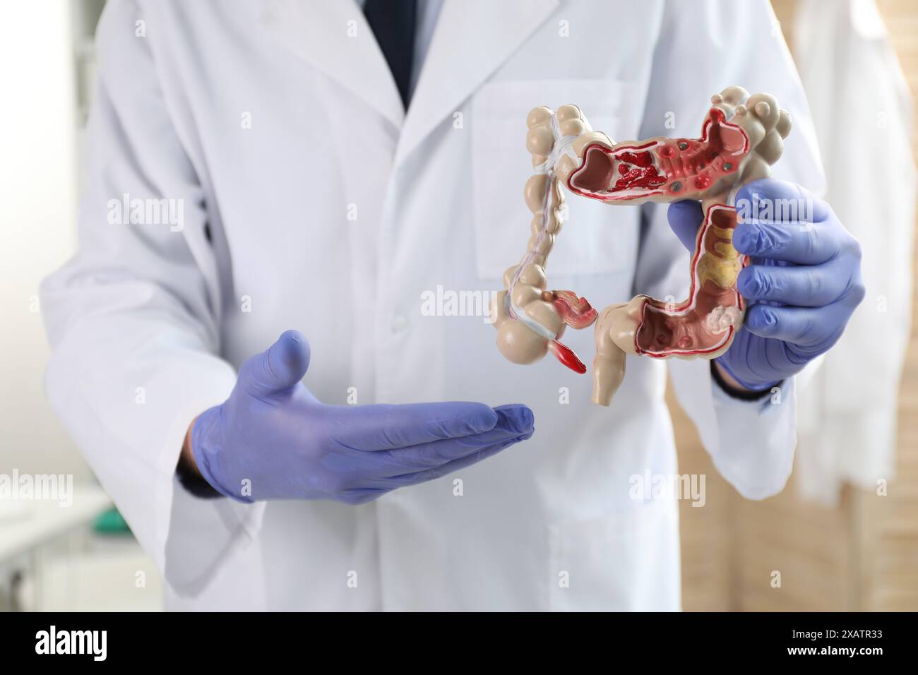 Doctor showing model of large intestine indoors, closeup Stock Photo ...