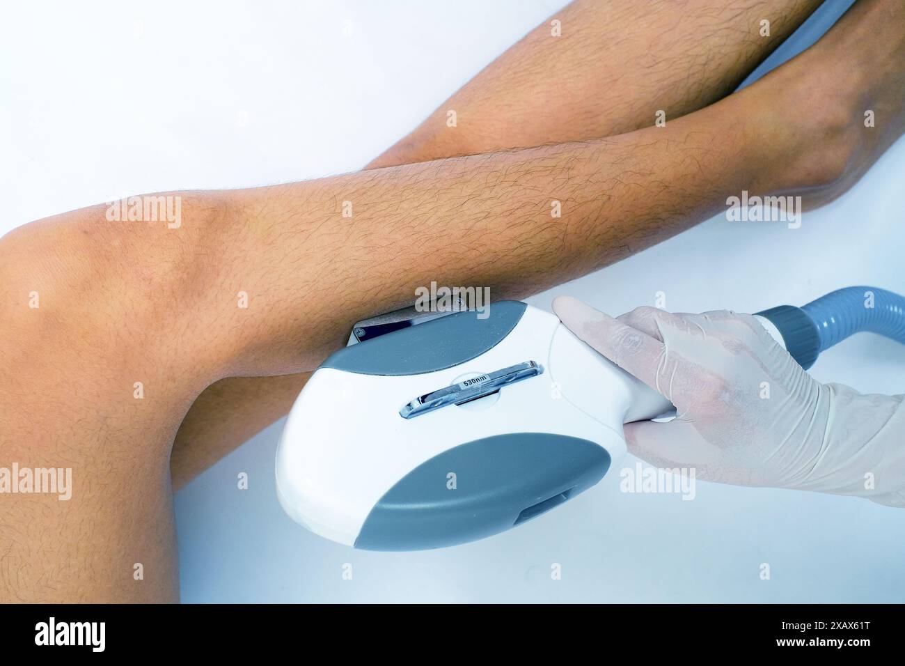 Effective Laser IPL (Intense Pulsed Light) Hair Removal for Smooth Legs ...