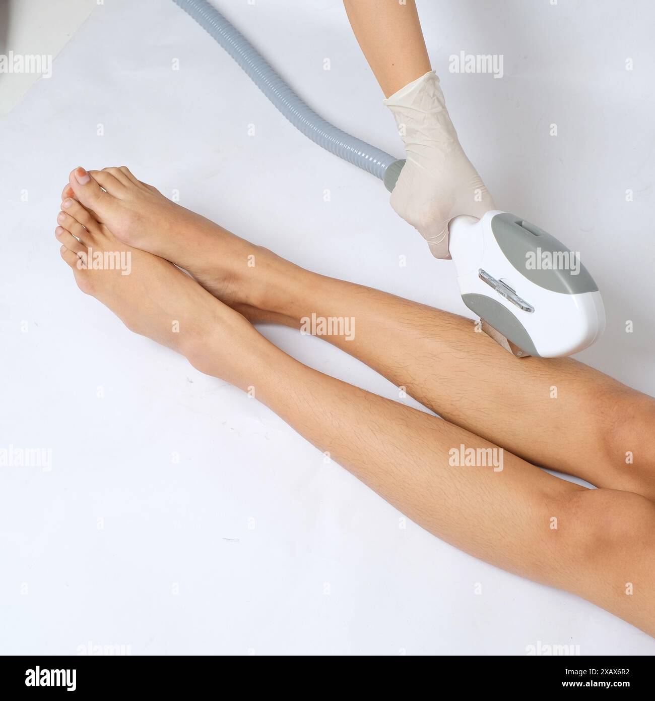 Ipl laser machine hi-res stock photography and images - Alamy