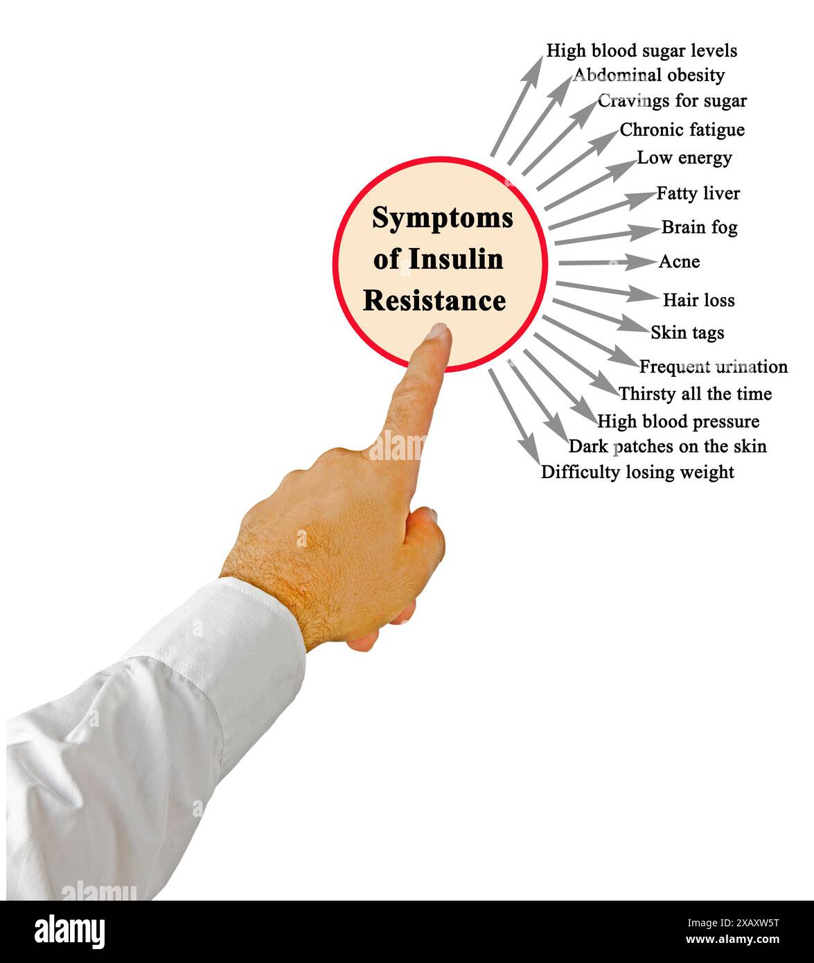 Fifteen Symptoms of Insulin Resistance Stock Photo - Alamy