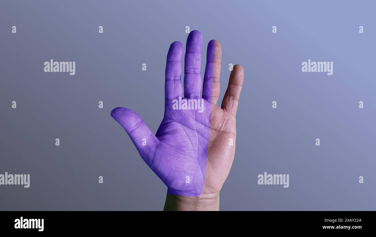 Medical background of the hand numbness Stock Photo - Alamy