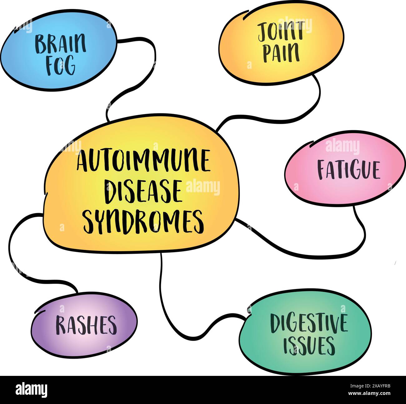 autoimmune disease syndromes, health and lifestyle concept, vector ...