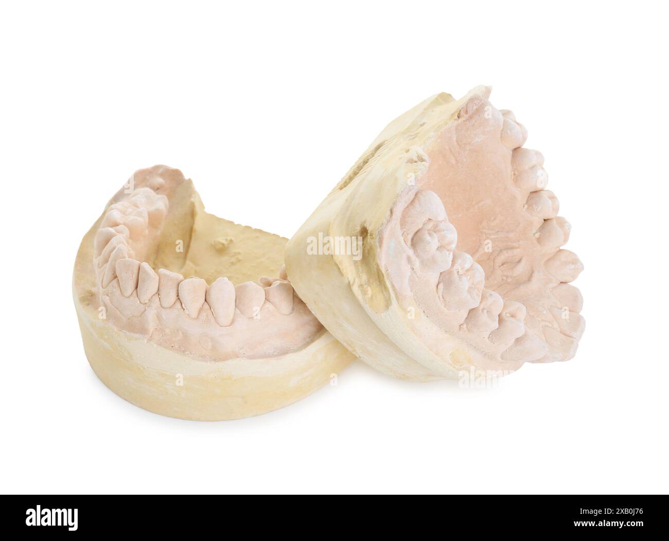 Dental model with jaws isolated on white. Cast of teeth Stock Photo - Alamy