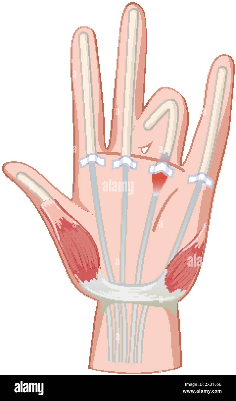 Detailed illustration of hand muscles and tendons Stock Vector Image ...