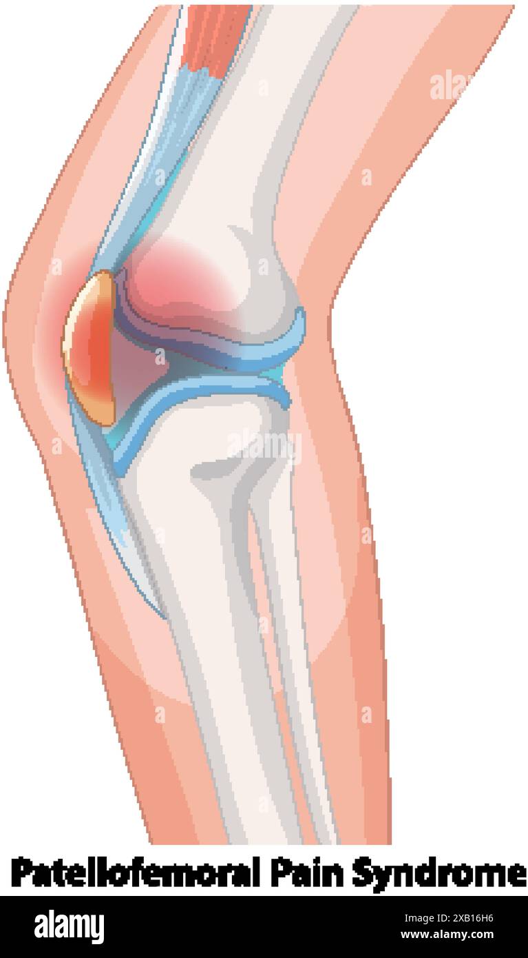 Detailed Vector Of Knee Joint Anatomy Stock Vector Image And Art Alamy