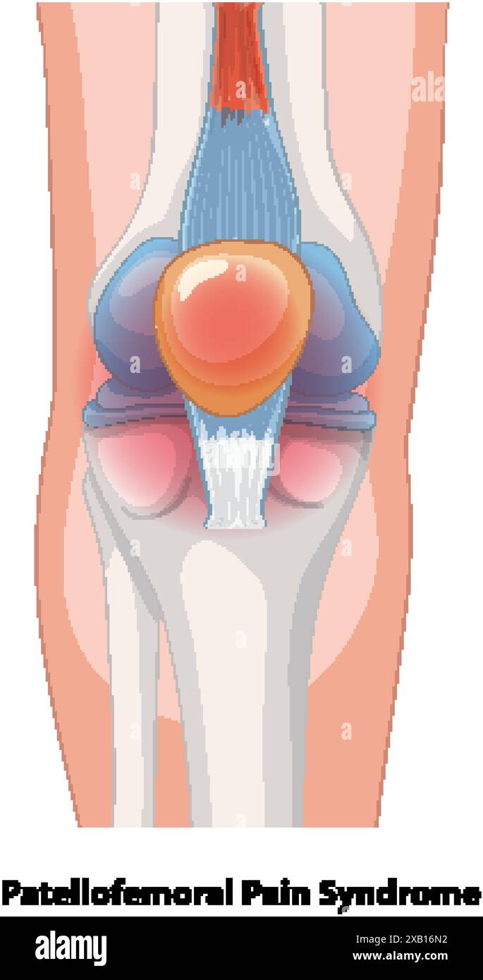 Detailed vector of knee joint anatomy Stock Vector Image & Art - Alamy Detailed vector of knee joint anatomy Stock Vector Image & Art - Alamy