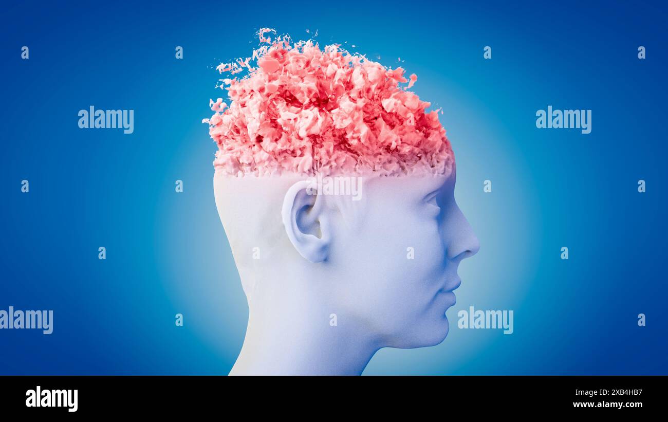 Face seen from the side. Degenerative disease. Brain degenerative ...