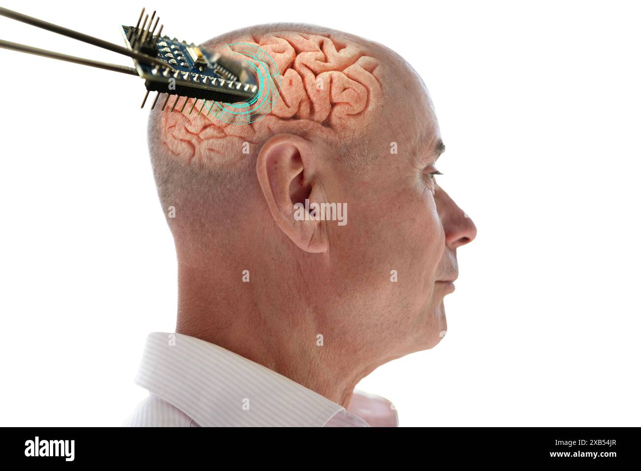 Installing electronic chip into human brain, applied in various fields ...