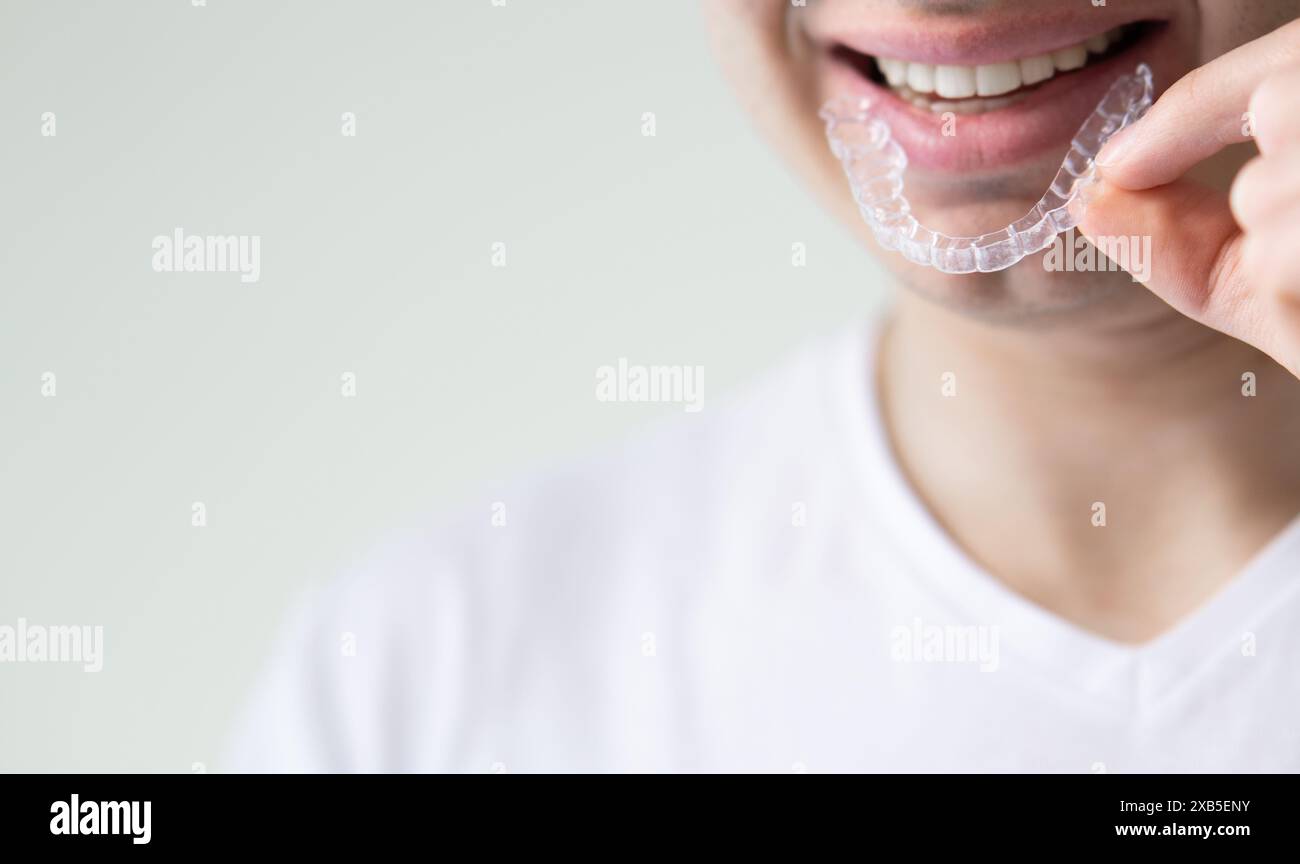 smiling young man with white straight teeth holding transparent dental ...