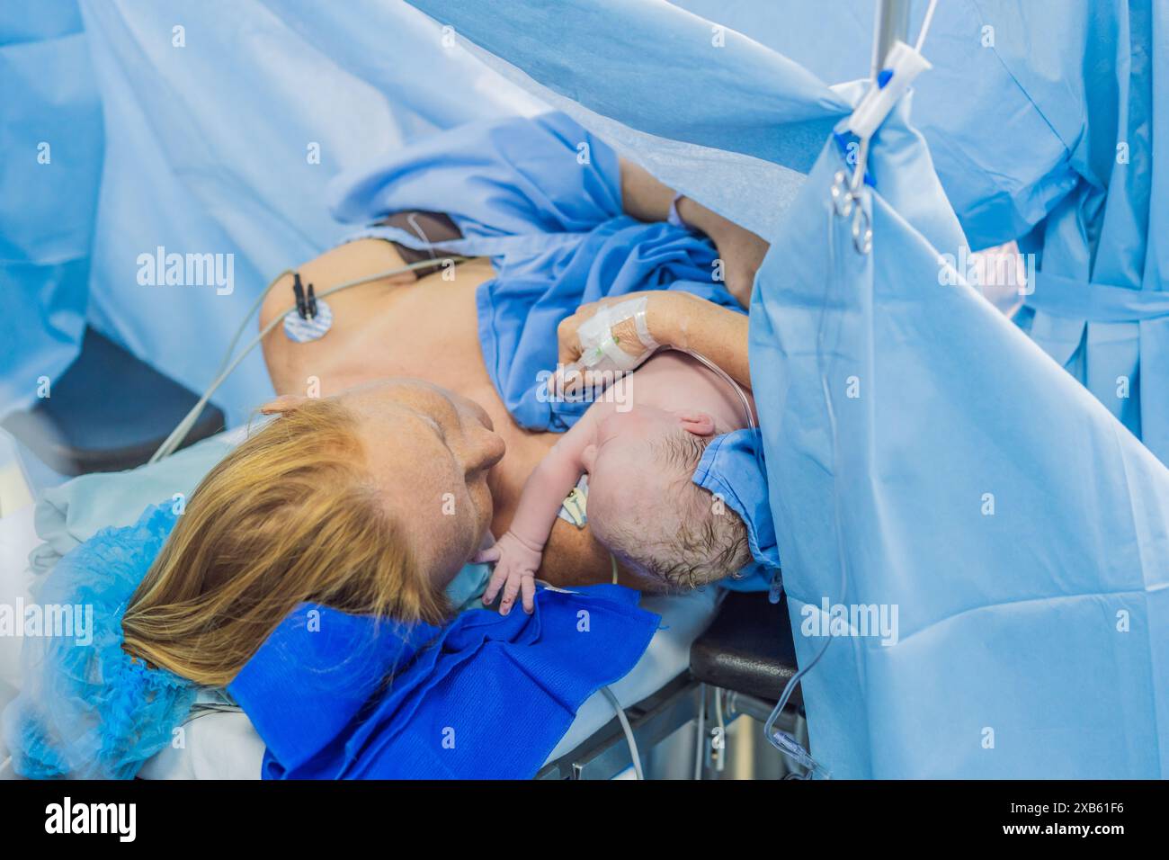 Baby on mother's chest immediately after birth in a hospital. The ...