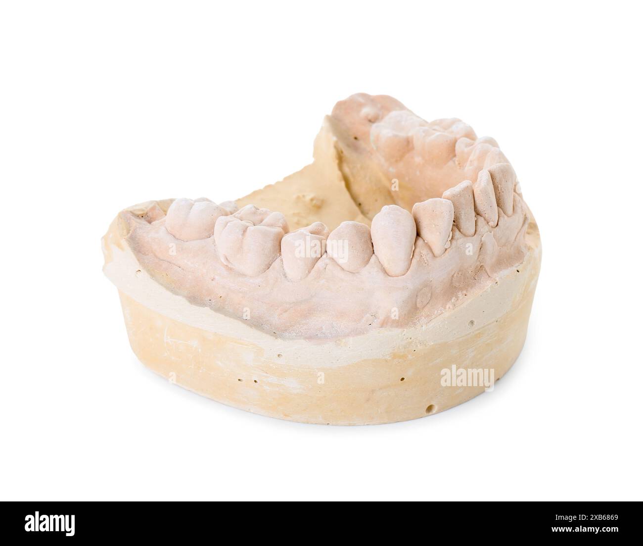 Dental model with jaw isolated on white. Cast of teeth Stock Photo - Alamy