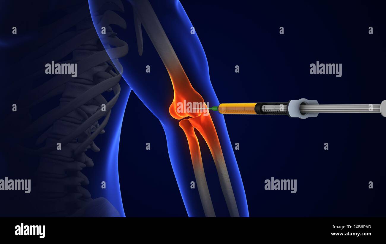 Anatomy Human elbow Joint Treatment Stock Photo - Alamy