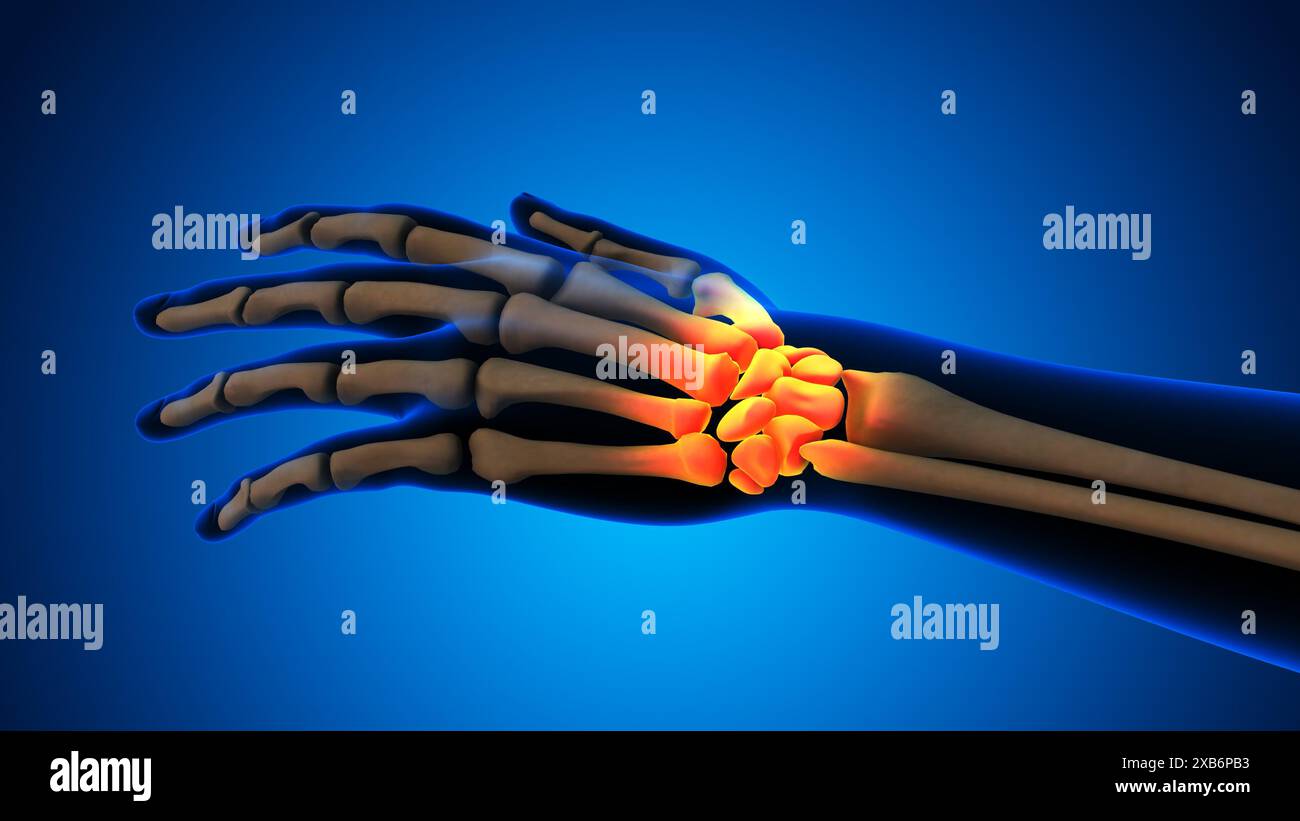 Pain in the wrist joint Stock Photo - Alamy