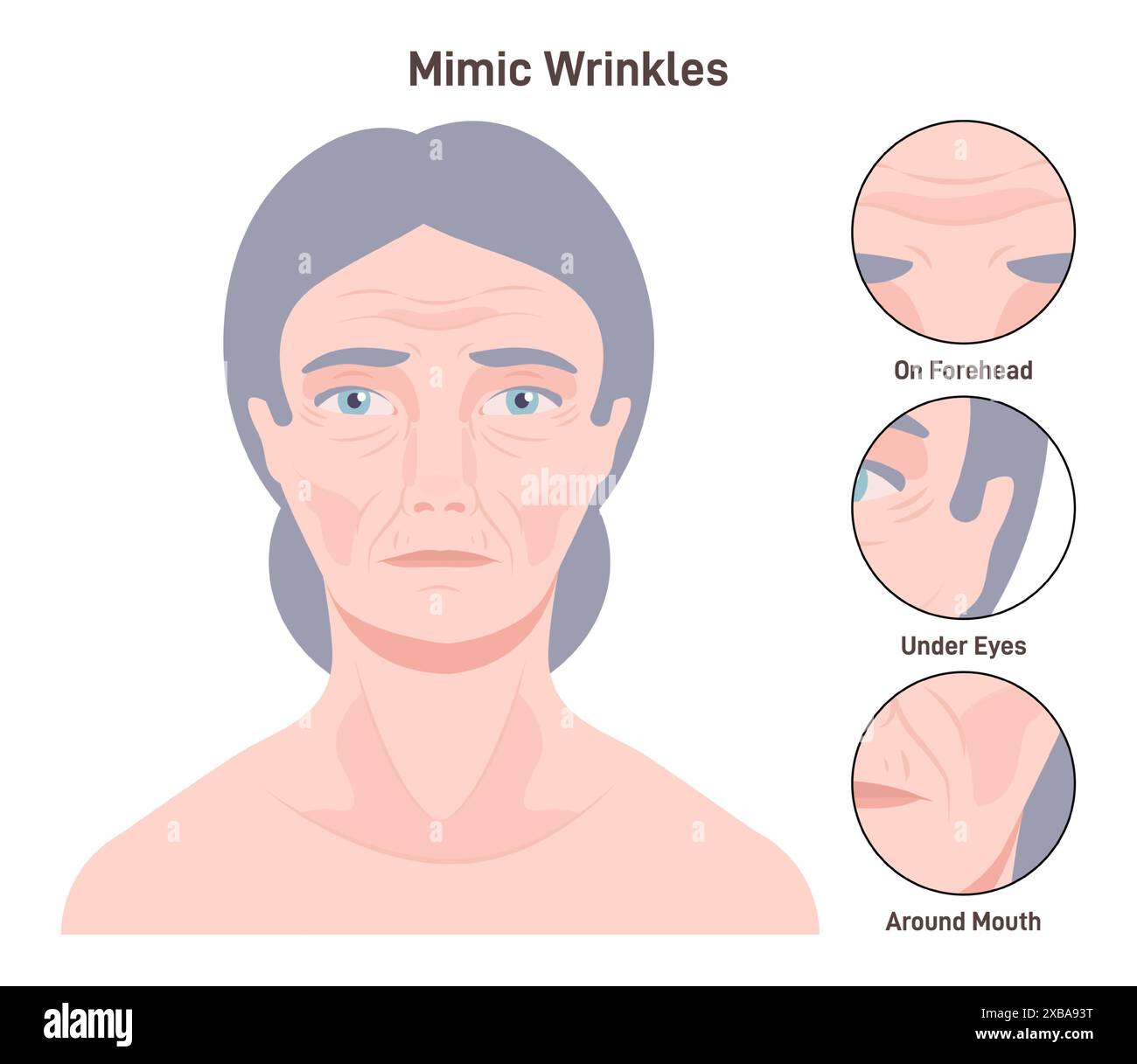Mimic wrinkles. Age-related skin changes. Aging process, forehead ...
