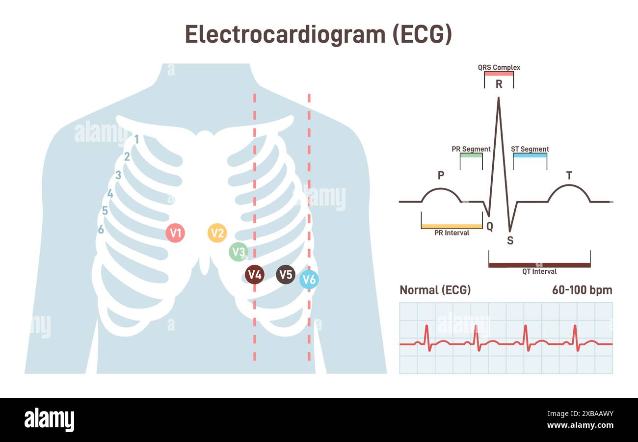 ECG procedure. Cardiovascular checkup with cardiogram. Heart disease ...