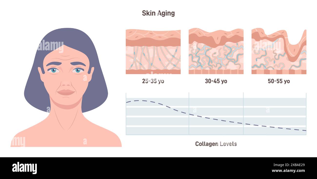 Aging process and the reduction of collagen levels in the skin. Close ...
