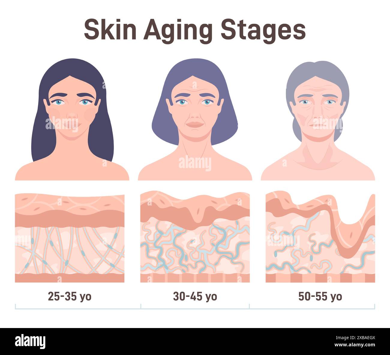 Aging process. Face skin structure changes. cross section diagram ...