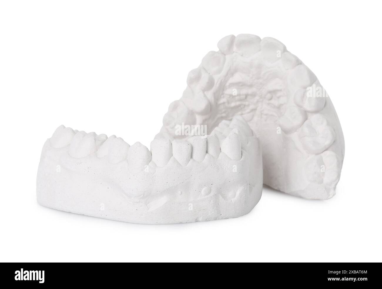 Dental model with gums isolated on white. Cast of teeth Stock Photo - Alamy