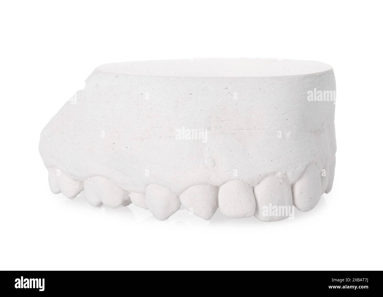 Dental model with gum isolated on white. Cast of teeth Stock Photo - Alamy