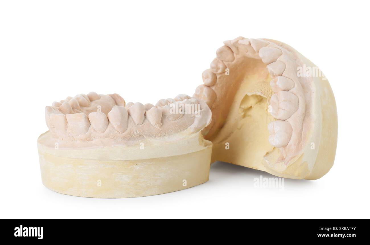 Dental model with jaws isolated on white. Cast of teeth Stock Photo - Alamy