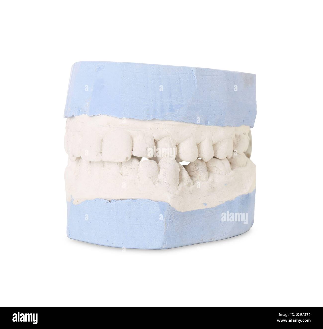 Dental model with gums isolated on white. Cast of teeth Stock Photo - Alamy