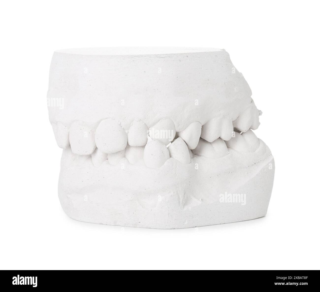 Dental model with gums isolated on white. Cast of teeth Stock Photo - Alamy